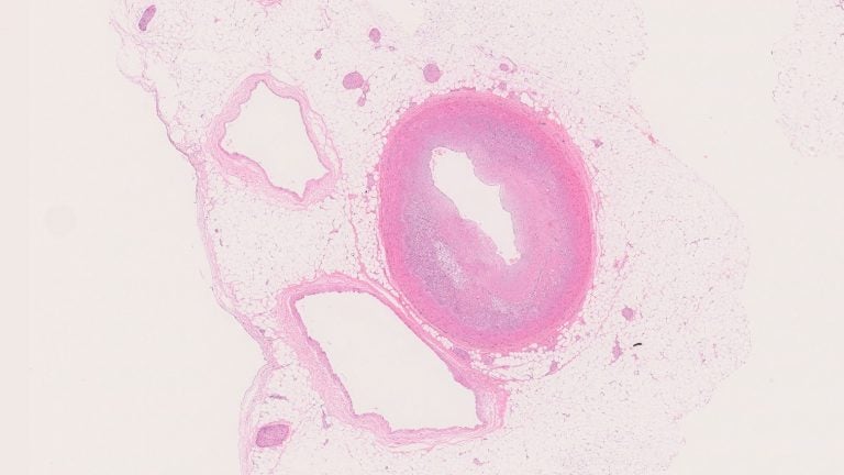 Blood vessels – Normal Histology – NUS Pathweb :: NUS Pathweb