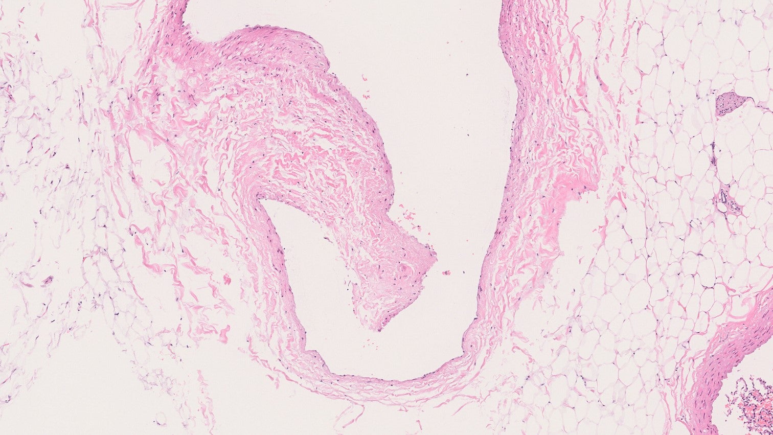 Blood vessels – Normal Histology – NUS Pathweb :: NUS Pathweb