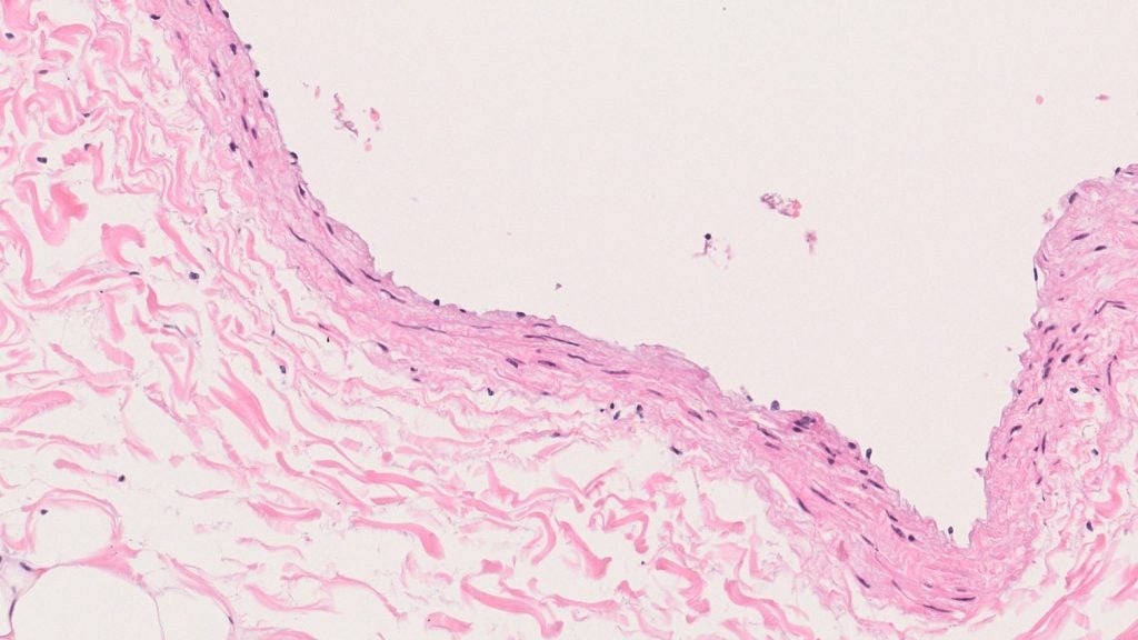 Blood vessels – Normal Histology – NUS Pathweb :: NUS Pathweb