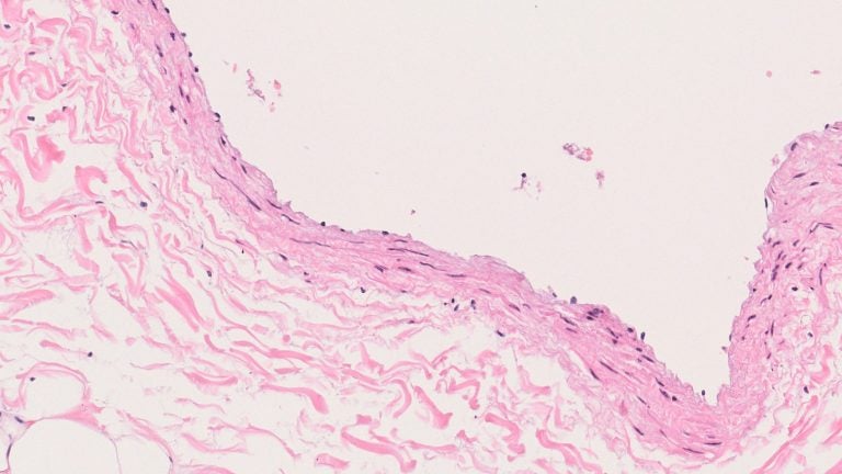 Blood vessels – Normal Histology – NUS Pathweb :: NUS Pathweb