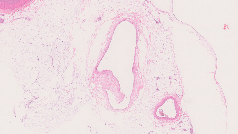 Blood vessels – Normal Histology – NUS Pathweb :: NUS Pathweb