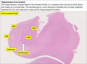 Brain – Hippocampus – NUS Pathweb :: NUS Pathweb