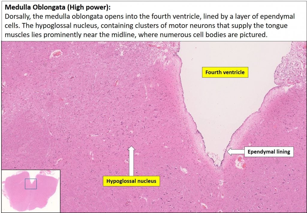 Brain – Medulla – NUS Pathweb :: NUS Pathweb