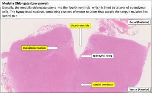 Brain – Medulla – NUS Pathweb :: NUS Pathweb