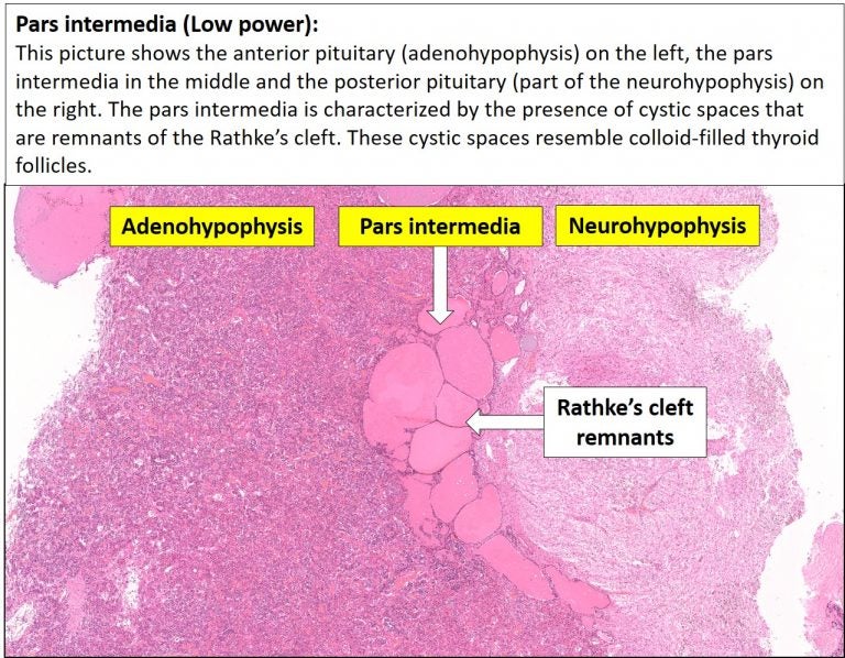 Brain – Pituitary – NUS Pathweb :: NUS Pathweb