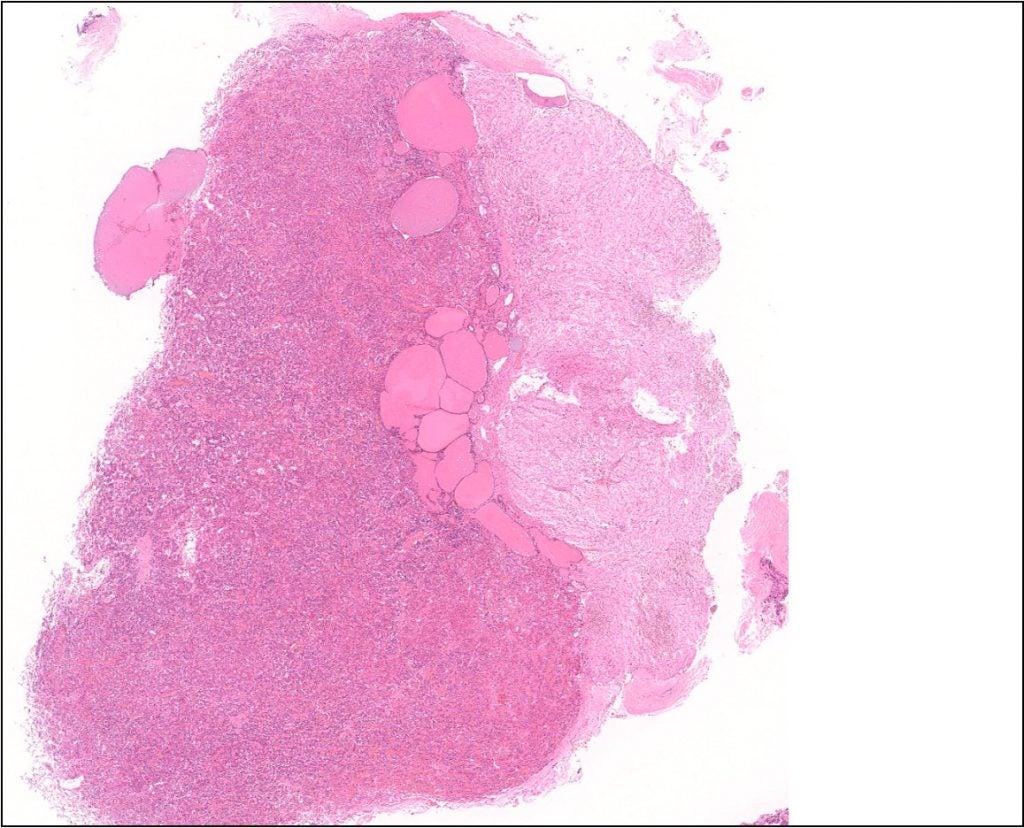 Brain – Pituitary – NUS Pathweb :: NUS Pathweb