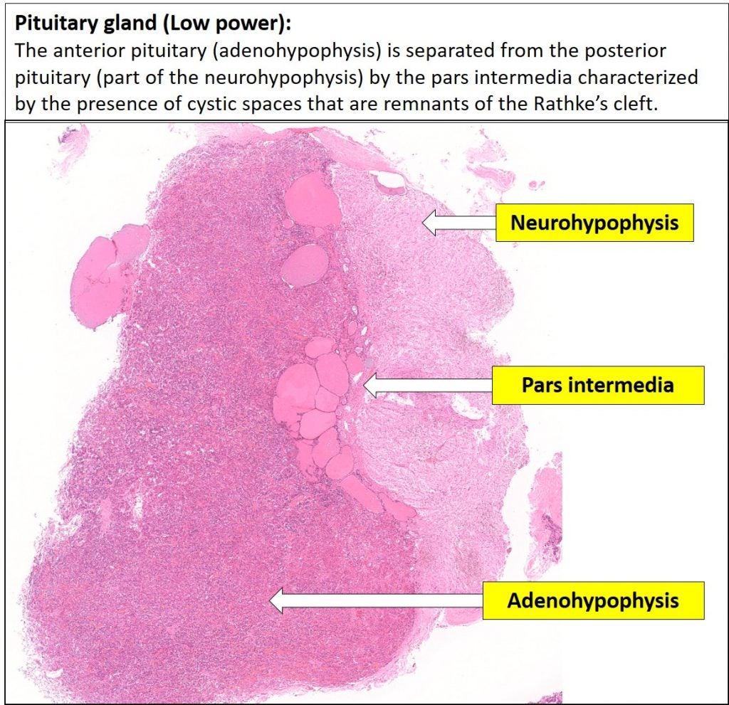 Brain – Pituitary – NUS Pathweb :: NUS Pathweb