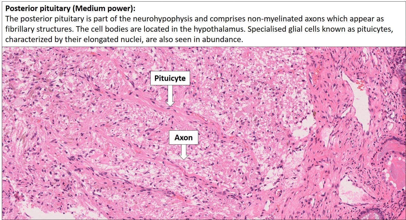 Brain – Pituitary – NUS Pathweb :: NUS Pathweb
