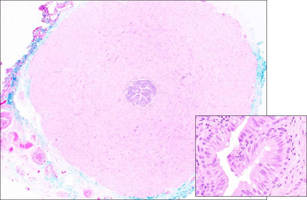 Vas deferens – Normal Histology – NUS Pathweb :: NUS Pathweb