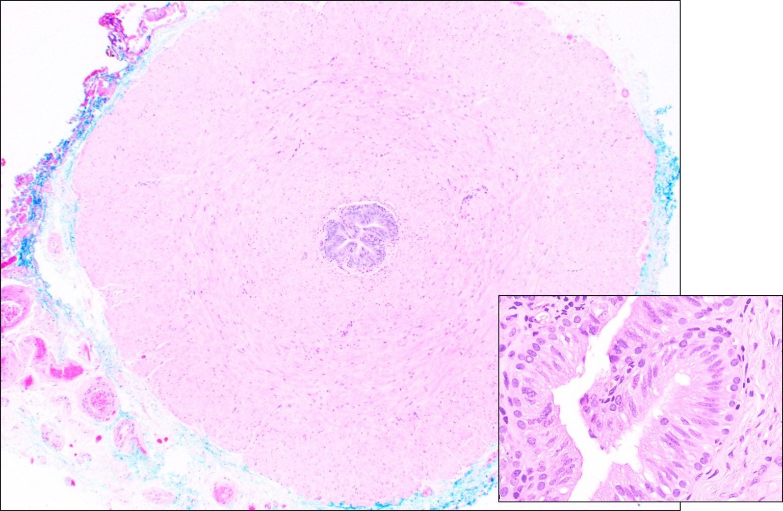 Vas deferens – Normal Histology – NUS Pathweb :: NUS Pathweb