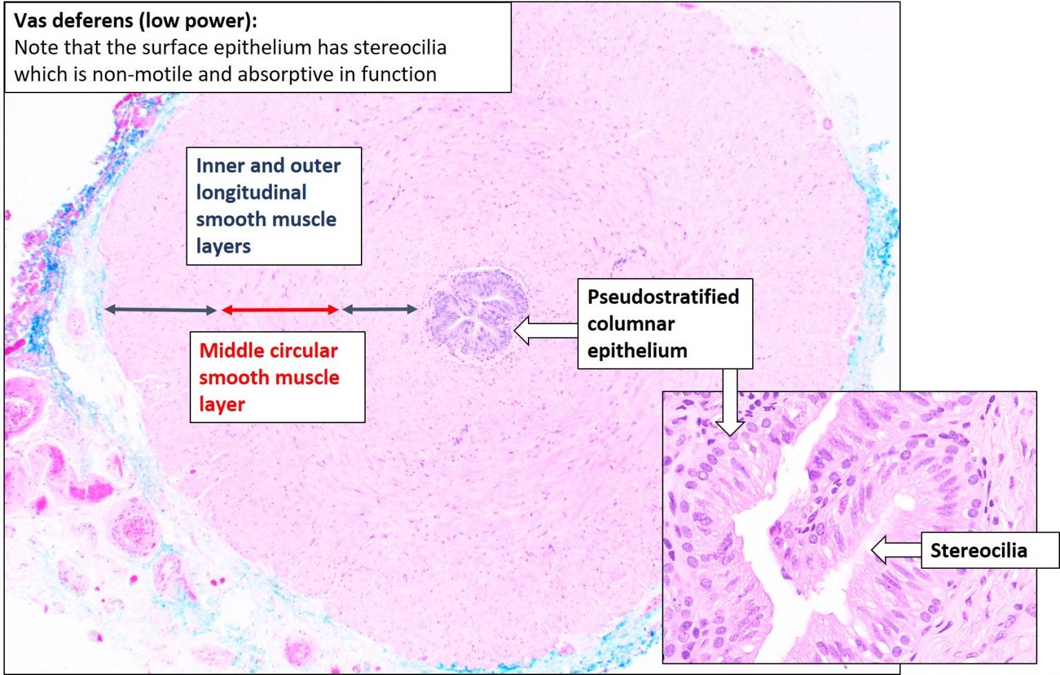 Vas deferens – Normal Histology – NUS Pathweb :: NUS Pathweb