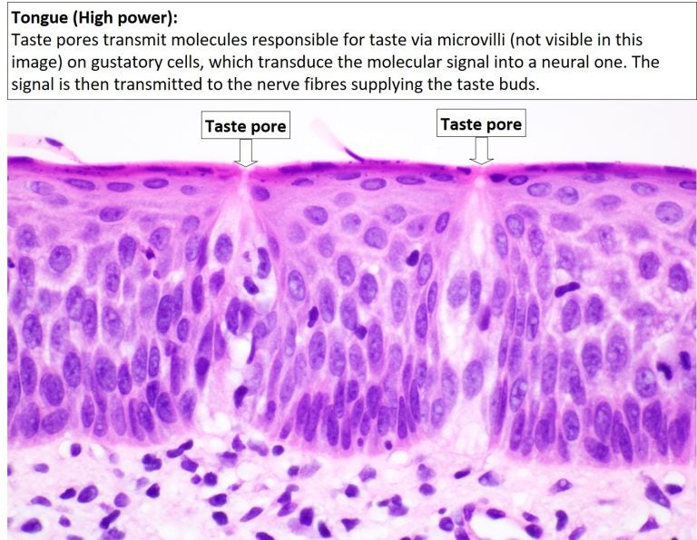 Tongue – Normal Histology – NUS Pathweb :: NUS Pathweb