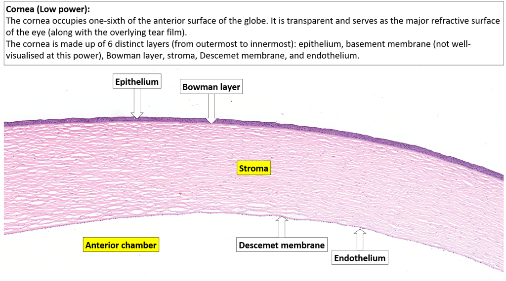 Eye – Cornea – NUS Pathweb :: NUS Pathweb