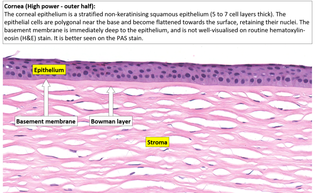 Eye – Cornea – NUS Pathweb :: NUS Pathweb