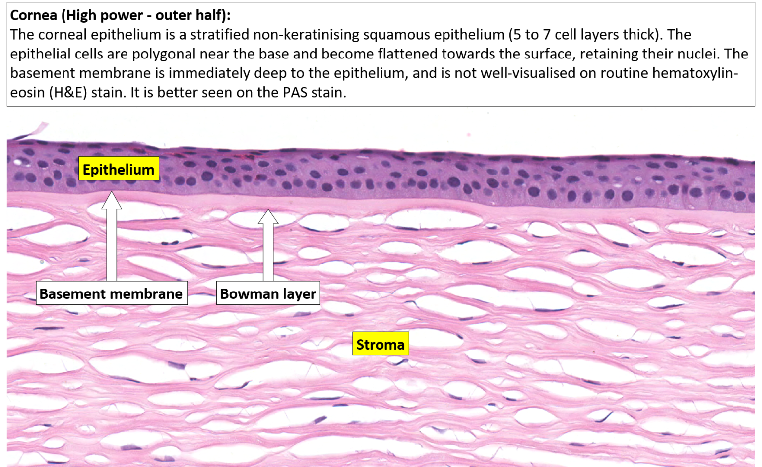 Eye – Cornea – NUS Pathweb :: NUS Pathweb