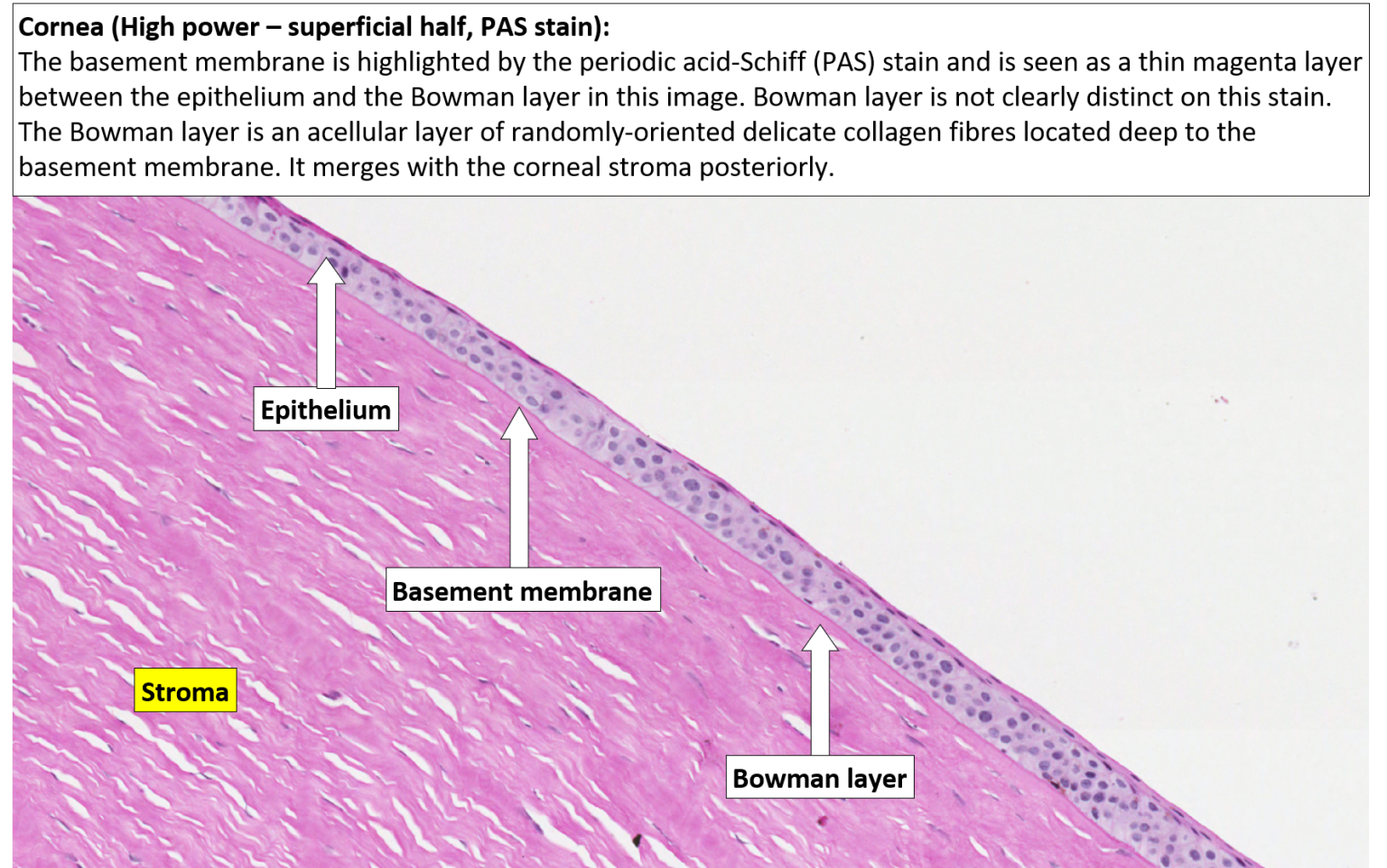 Eye – Cornea – NUS Pathweb :: NUS Pathweb