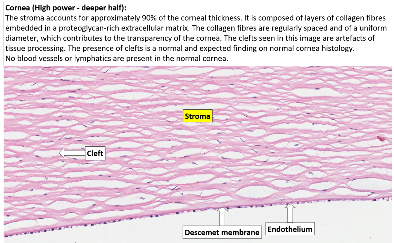 Eye – Cornea – NUS Pathweb :: NUS Pathweb