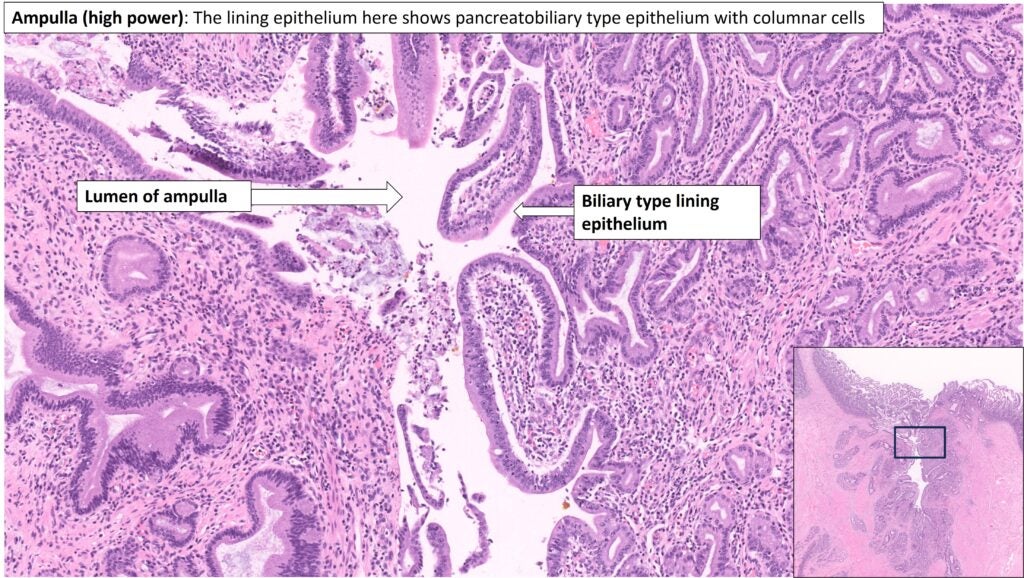 Ampulla – Normal Histology – NUS Pathweb :: NUS Pathweb