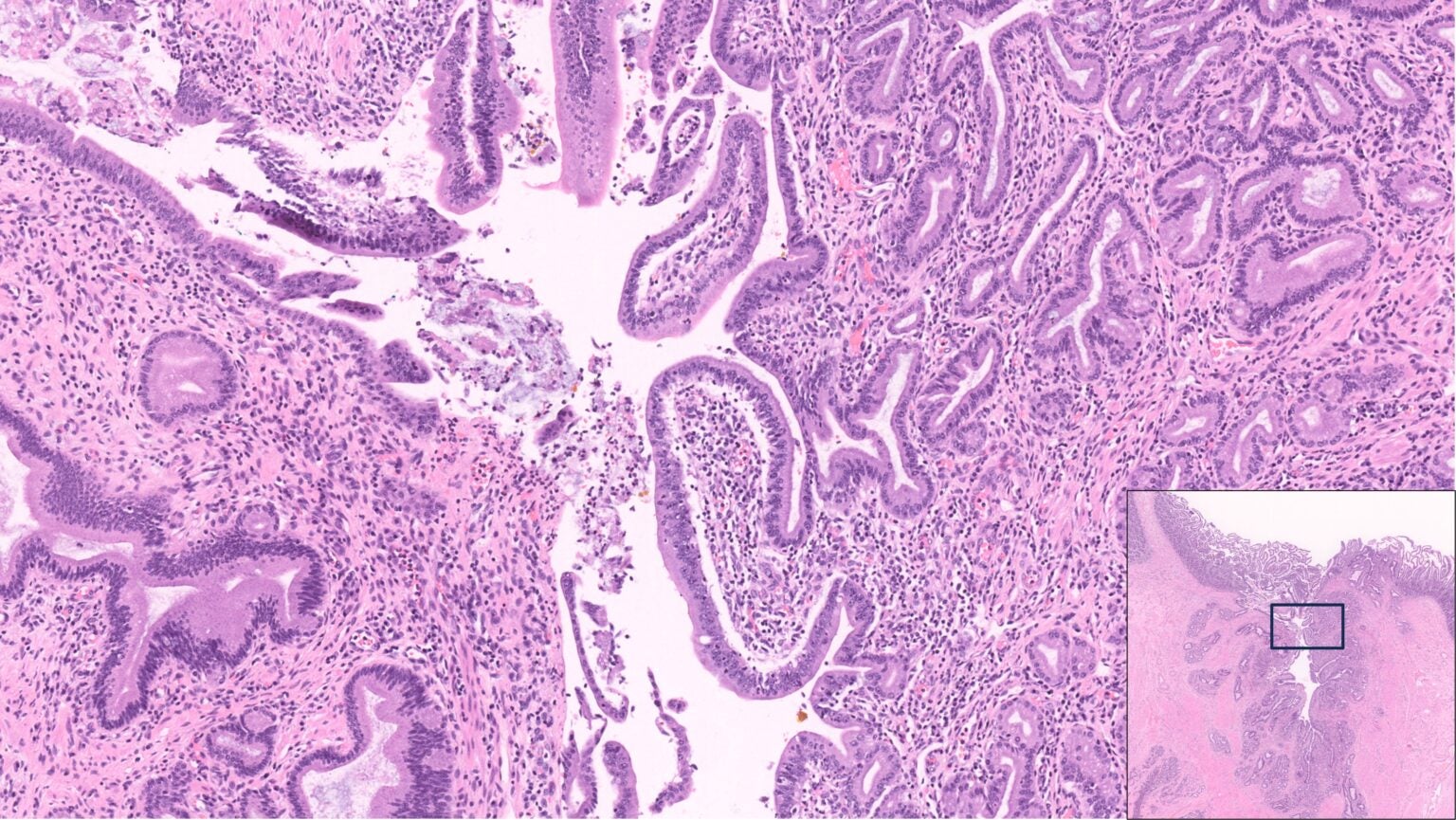 Ampulla – Normal Histology – NUS Pathweb :: NUS Pathweb