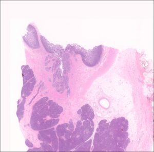 Ampulla – Normal Histology – NUS Pathweb :: NUS Pathweb
