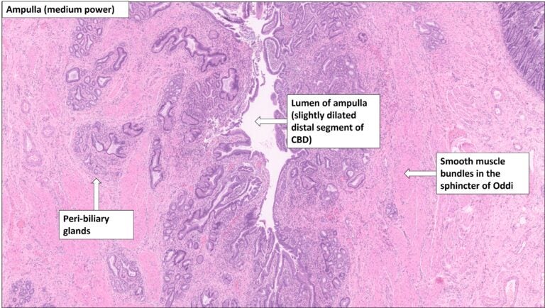 Ampulla – Normal Histology – NUS Pathweb :: NUS Pathweb