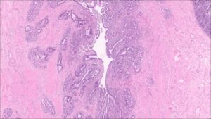 Ampulla – Normal Histology – NUS Pathweb :: NUS Pathweb