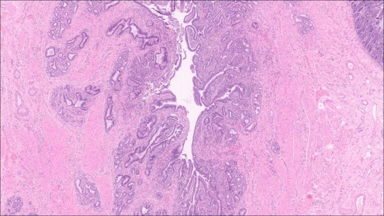 Ampulla – Normal Histology – NUS Pathweb :: NUS Pathweb