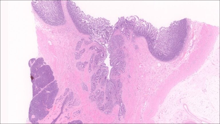 Ampulla – Normal Histology – NUS Pathweb :: NUS Pathweb