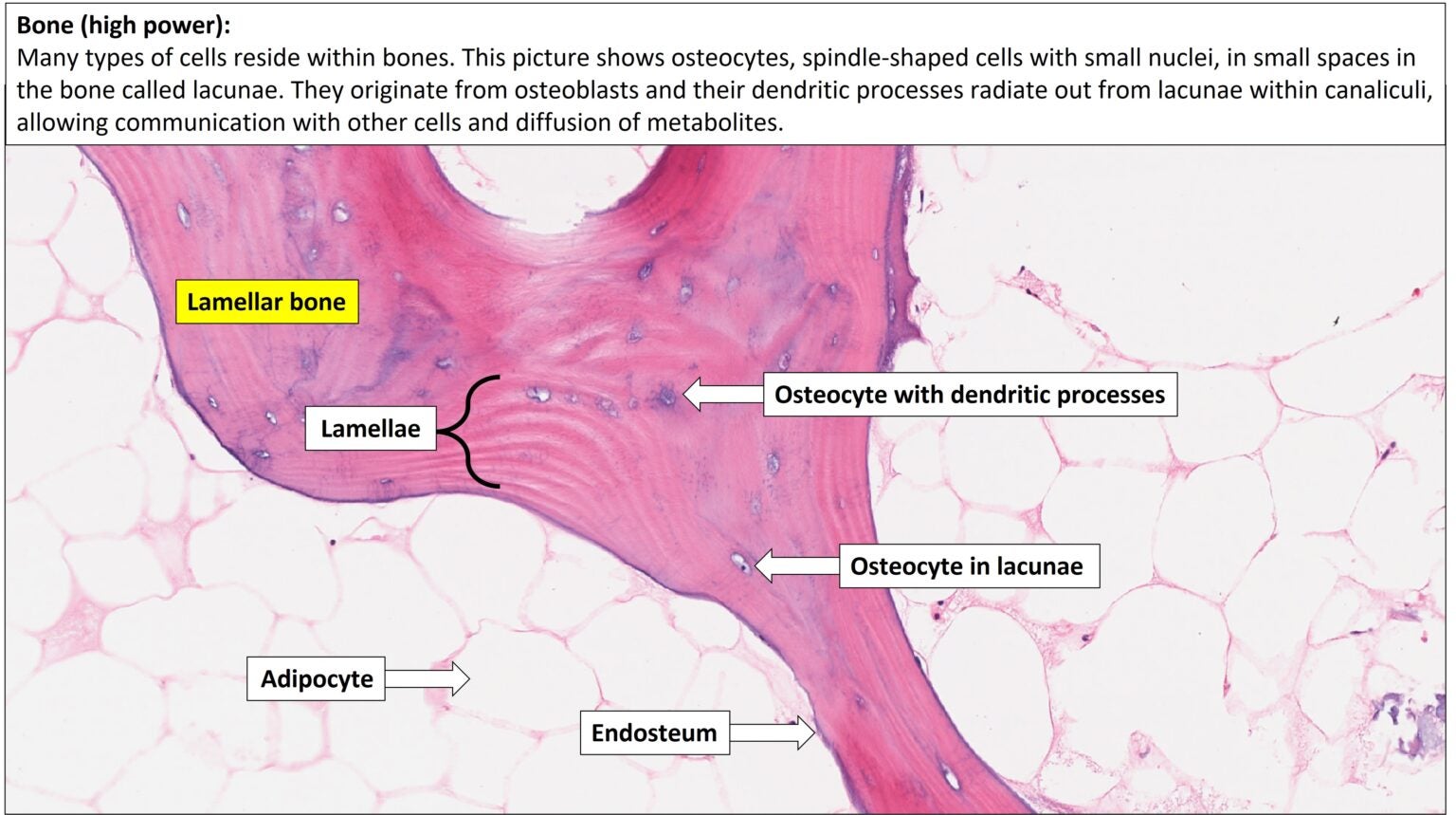 Bone – Normal Histology – NUS Pathweb :: NUS Pathweb