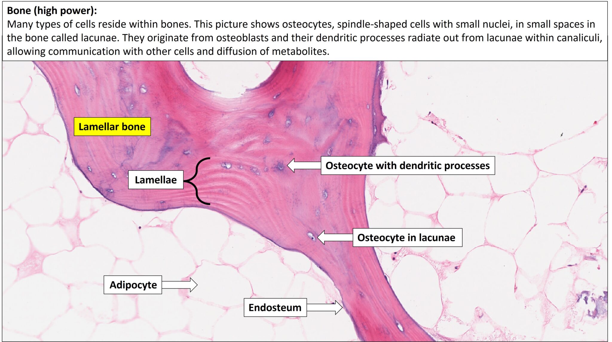 Bone – Normal Histology – NUS Pathweb :: NUS Pathweb