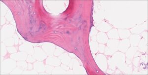 Bone – Normal Histology – NUS Pathweb :: NUS Pathweb