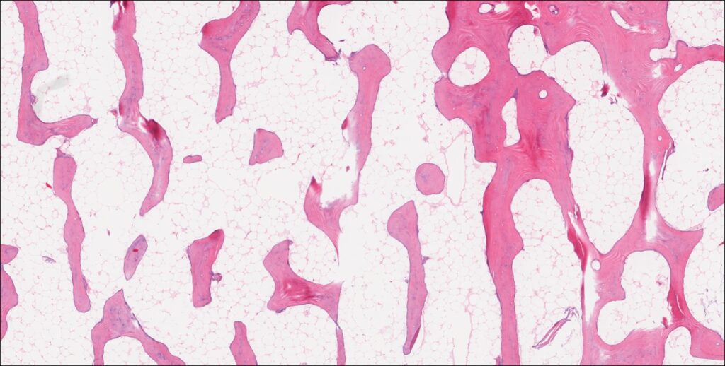 Bone – Normal Histology – NUS Pathweb :: NUS Pathweb