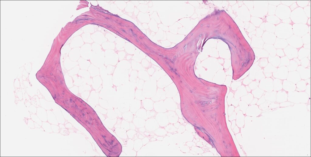 Bone – Normal Histology – NUS Pathweb :: NUS Pathweb
