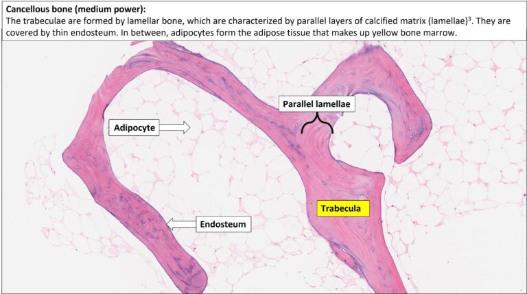 Bone – Normal Histology – NUS Pathweb :: NUS Pathweb