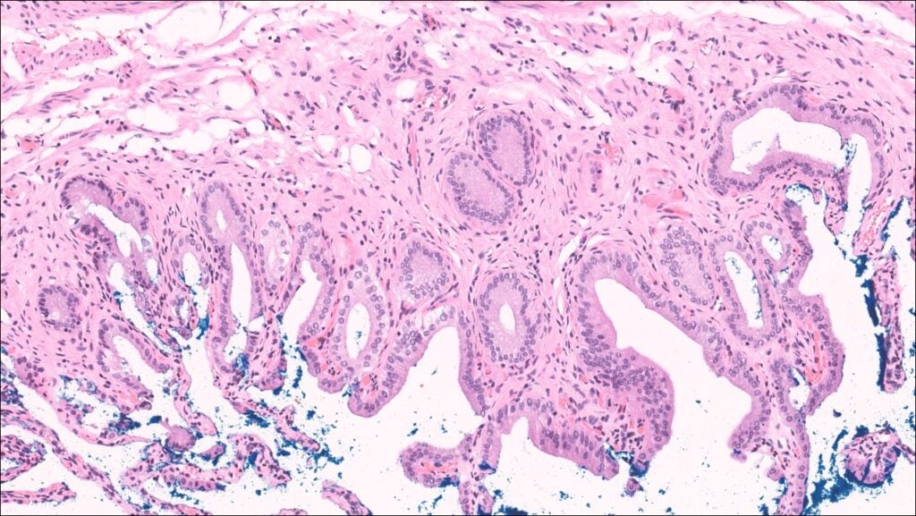 Gallbladder – Normal Histology – NUS Pathweb :: NUS Pathweb