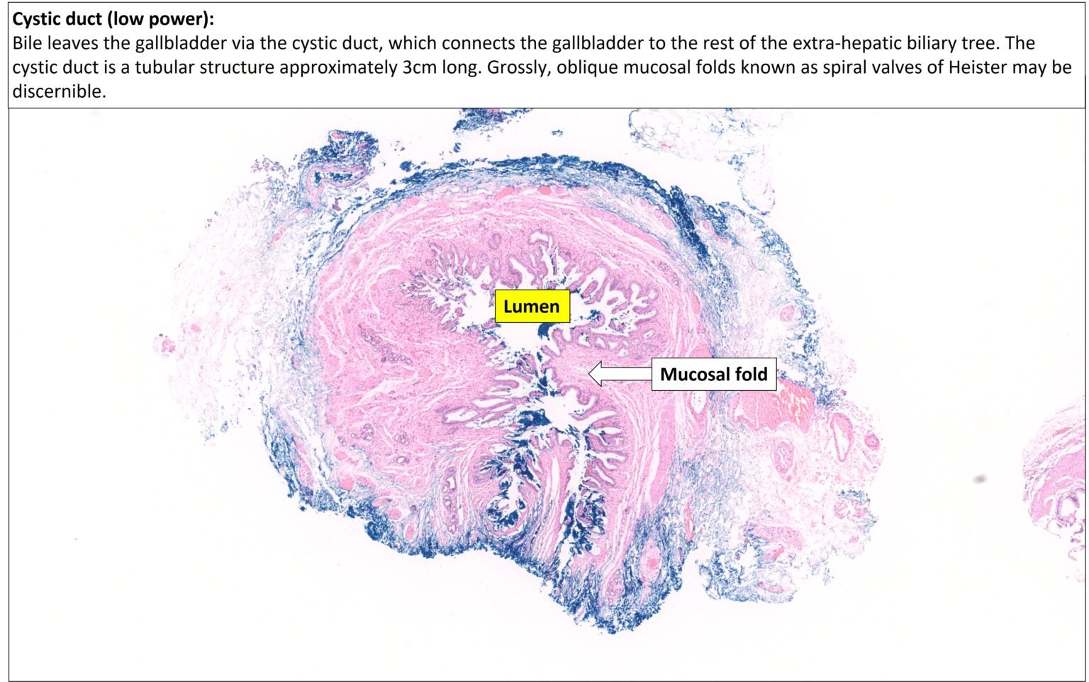Gallbladder – Normal Histology – NUS Pathweb :: NUS Pathweb
