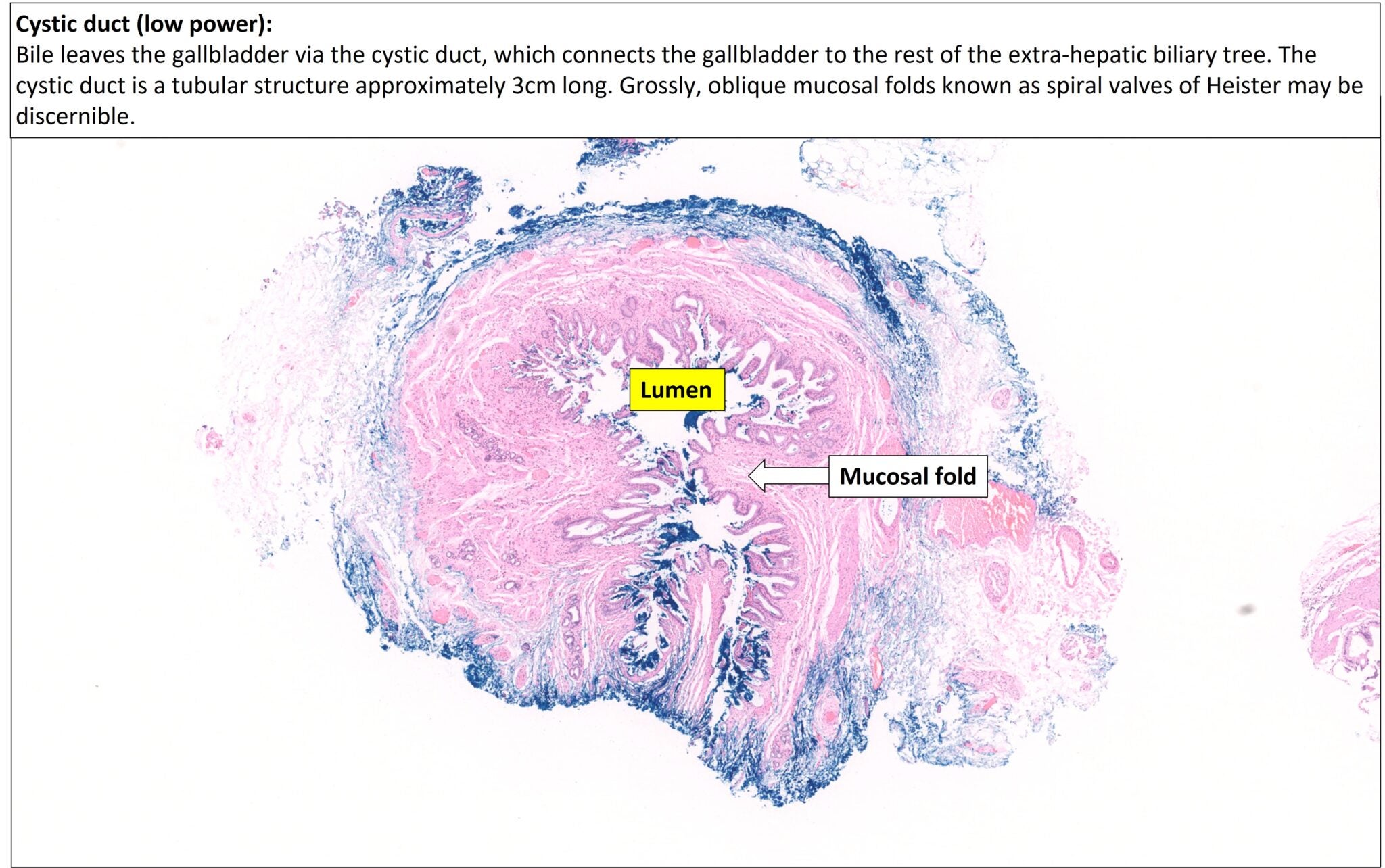 Gallbladder – Normal Histology – NUS Pathweb :: NUS Pathweb