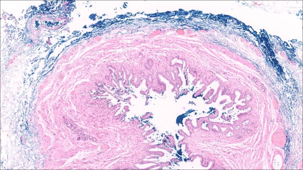 Gallbladder – Normal Histology – NUS Pathweb :: NUS Pathweb