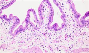 Gallbladder – Normal Histology – NUS Pathweb :: NUS Pathweb