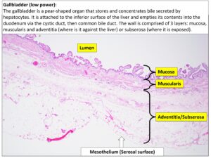 Gallbladder – Normal Histology – NUS Pathweb :: NUS Pathweb