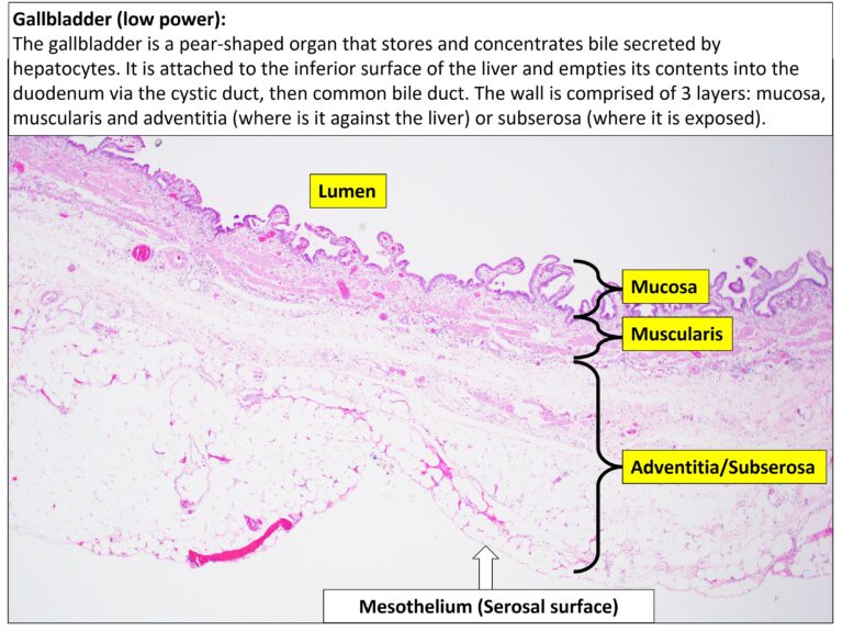Gallbladder – Normal Histology – NUS Pathweb :: NUS Pathweb