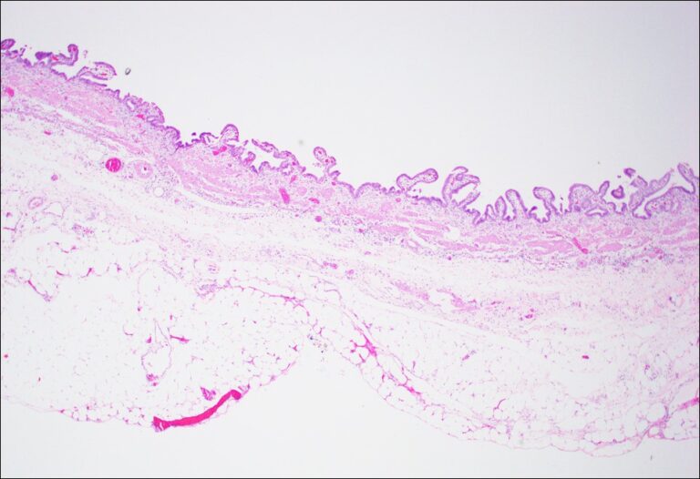 Gallbladder – Normal Histology – NUS Pathweb :: NUS Pathweb