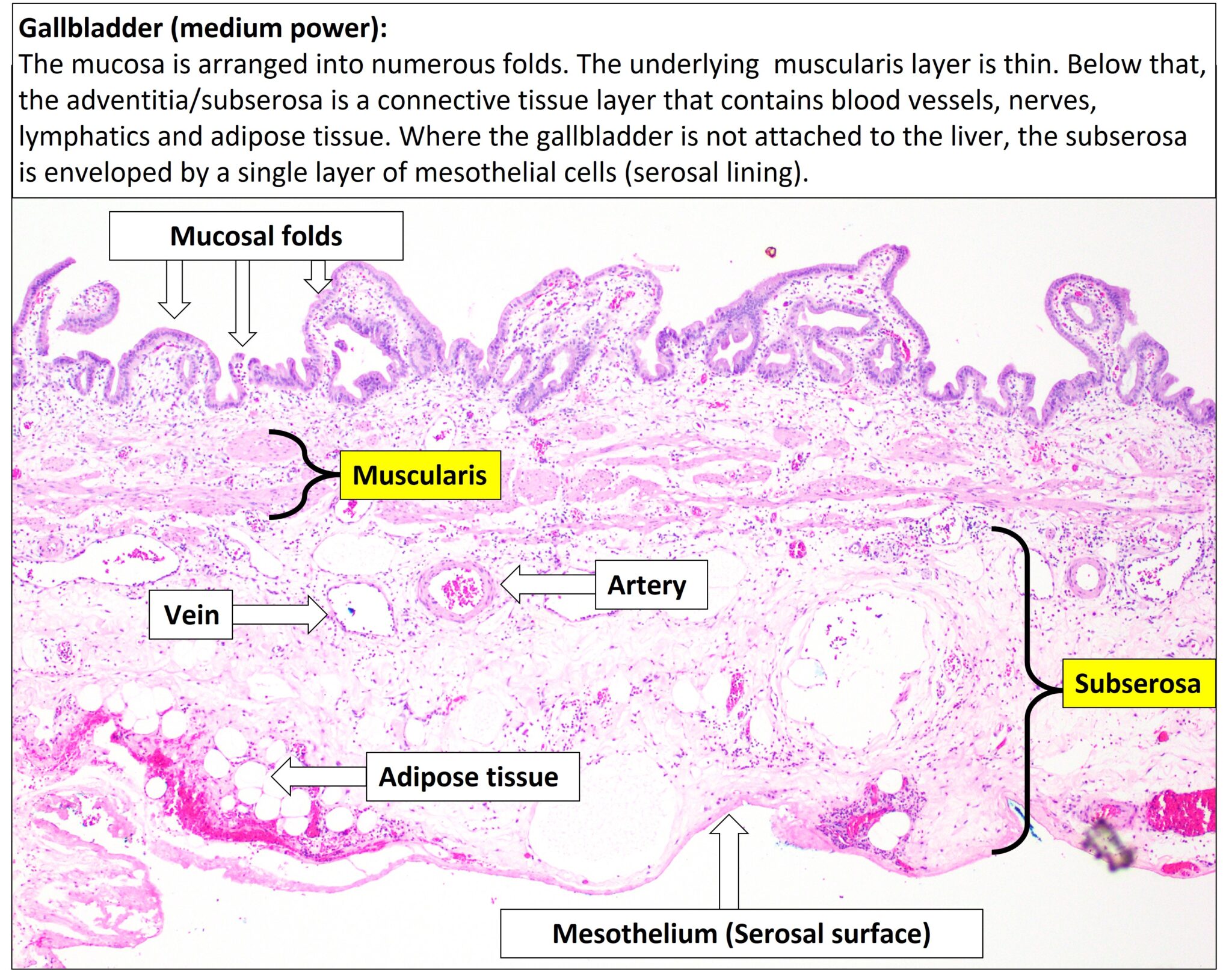 Gallbladder – Normal Histology – NUS Pathweb :: NUS Pathweb