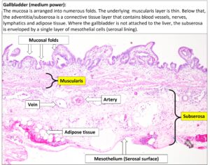 Gallbladder – Normal Histology – NUS Pathweb :: NUS Pathweb