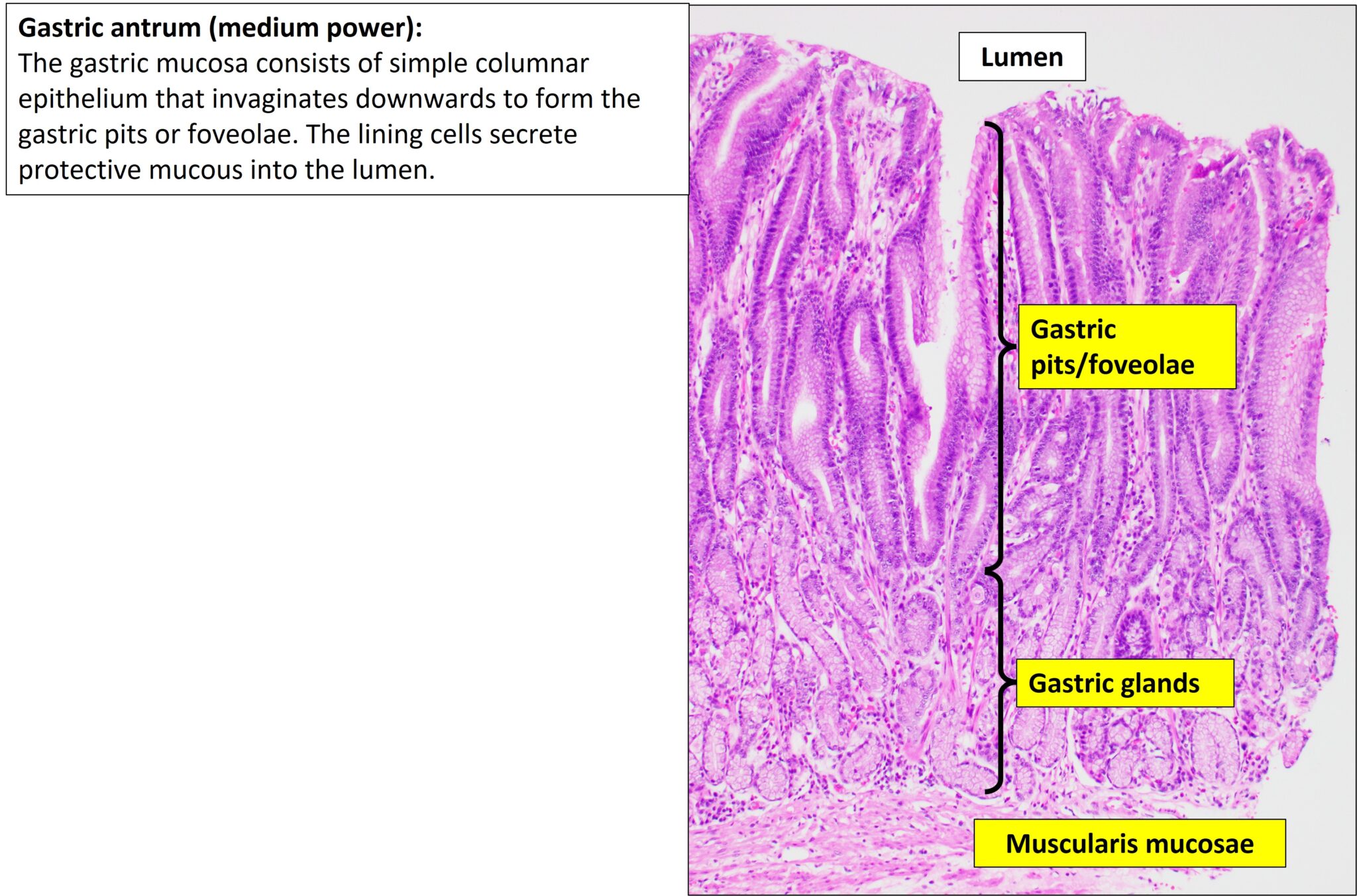 Stomach – Normal Histology – NUS Pathweb :: NUS Pathweb