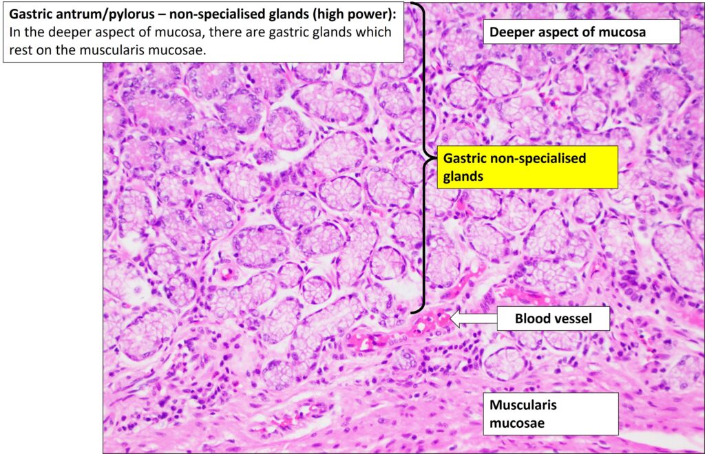 Stomach – Normal Histology – NUS Pathweb :: NUS Pathweb