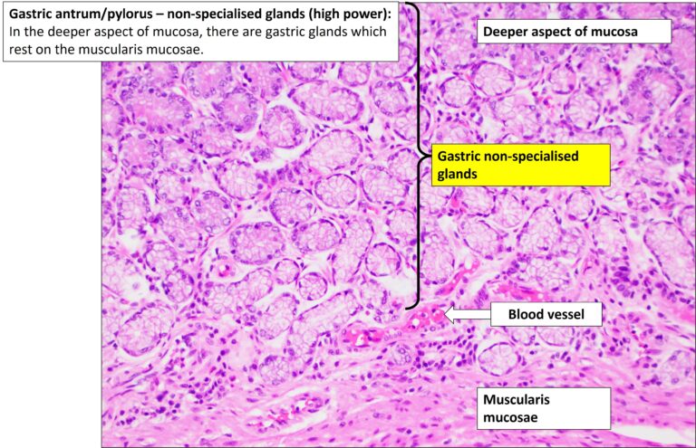 Stomach – Normal Histology – NUS Pathweb :: NUS Pathweb