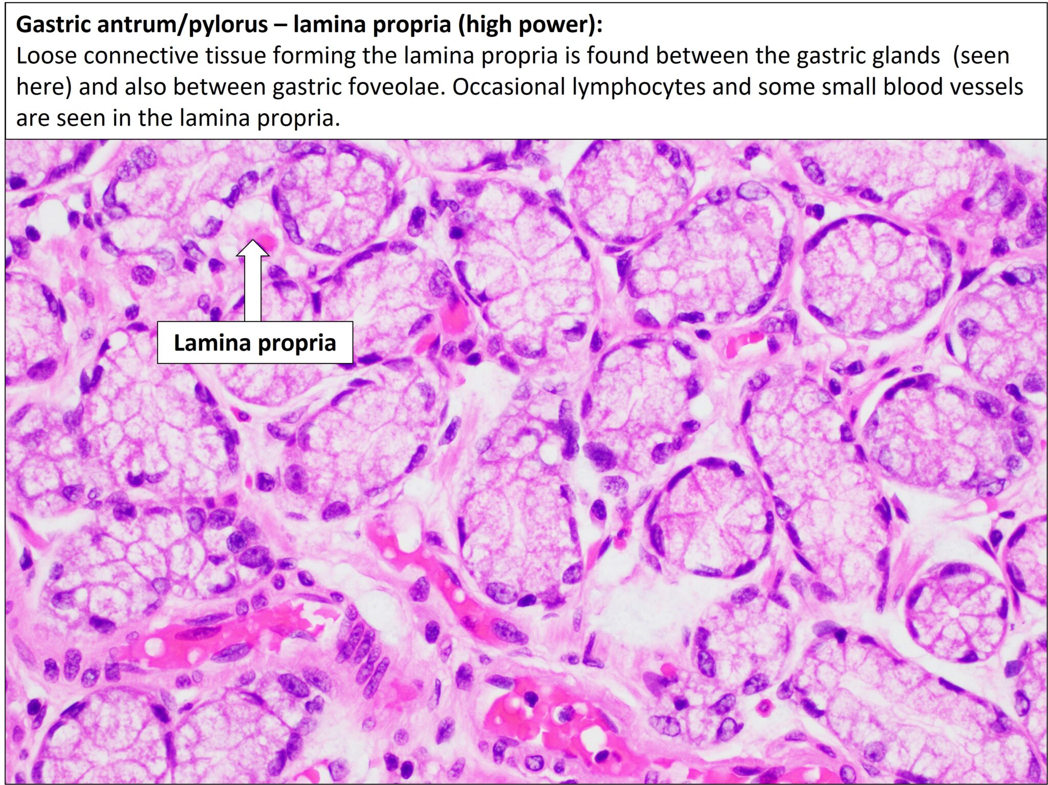 Stomach – Normal Histology – NUS Pathweb :: NUS Pathweb