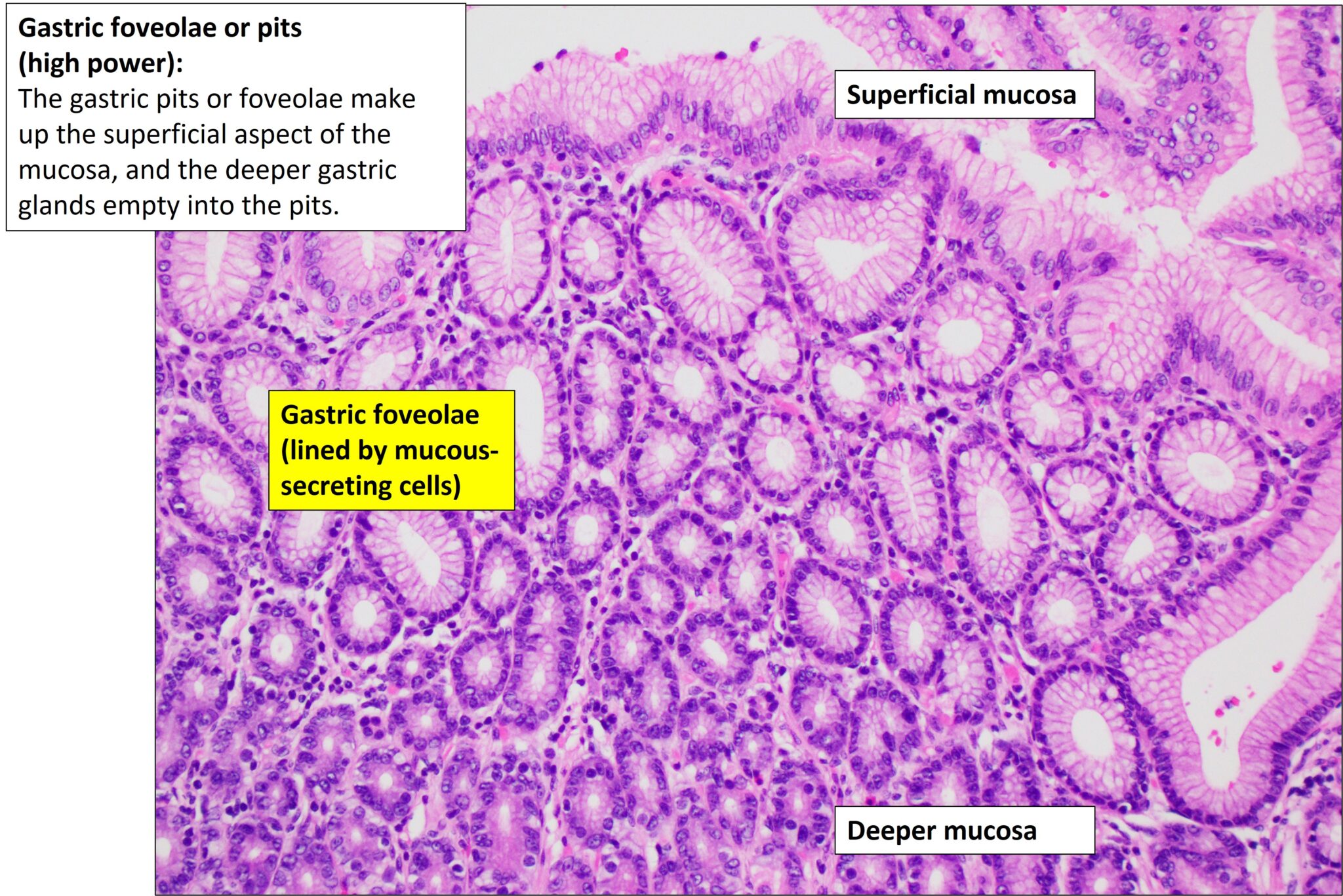 Stomach – Normal Histology – NUS Pathweb :: NUS Pathweb