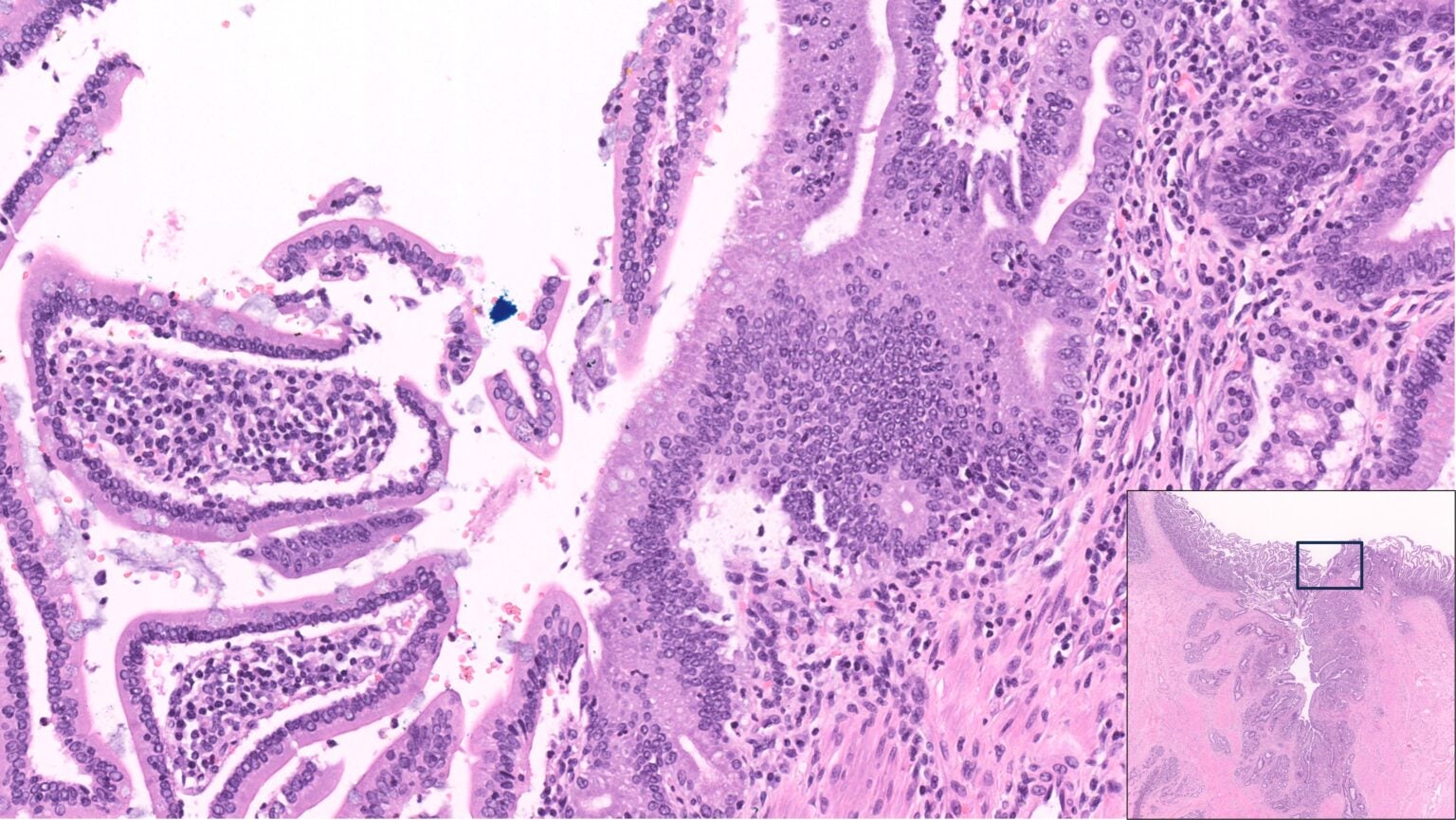 Ampulla – Normal Histology – NUS Pathweb :: NUS Pathweb